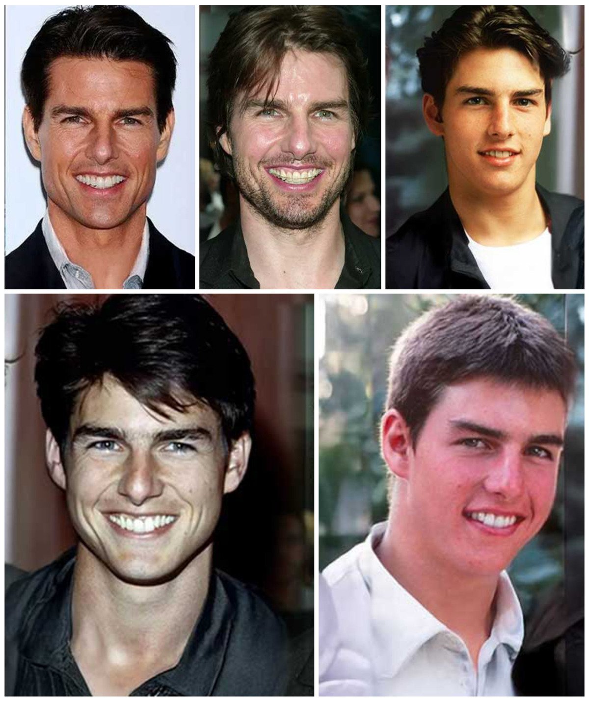 The Story Behind Tom Cruise’s Teeth: Middle Tooth to Signature Smile